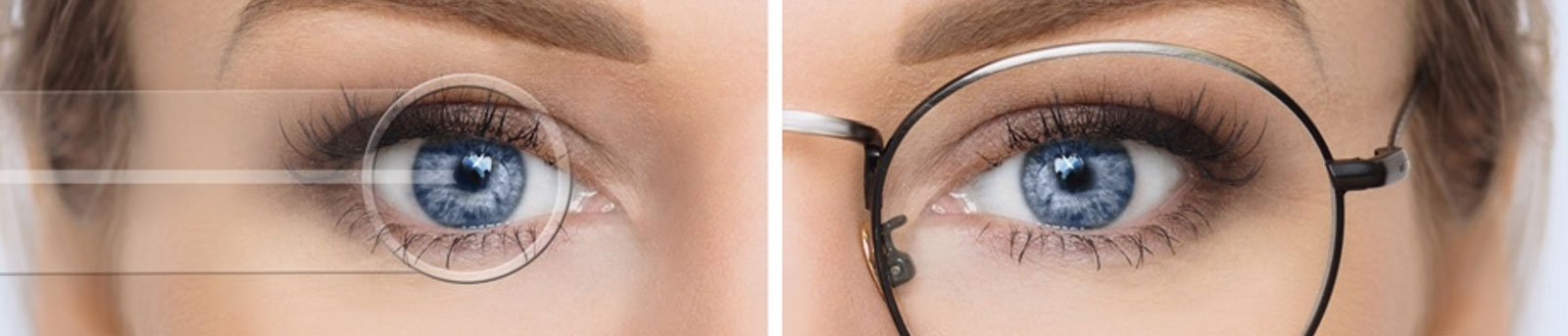Advanced Private Cataract Surgery in East & West UK | Eye Correction Centre