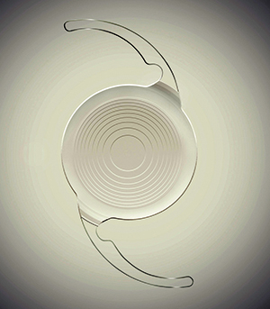 Eye Lens Replacement Surgery - Premium Lens Implant Surgery UK